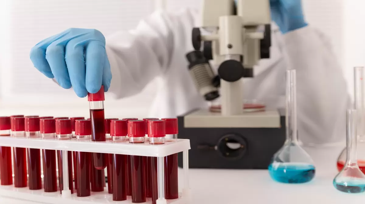 Fasting vs Non-Fasting Blood Tests: When Is Fasting Required?